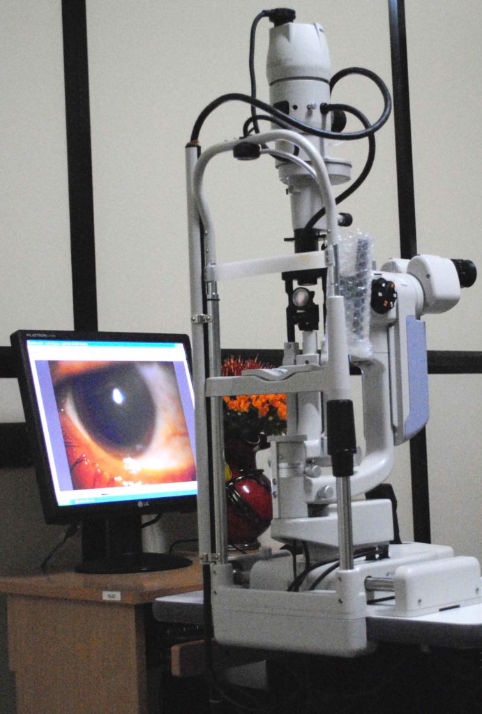 Slit lamp biomicroscopy - Pioneering Instrument to Diagnose Ophtalmic ...